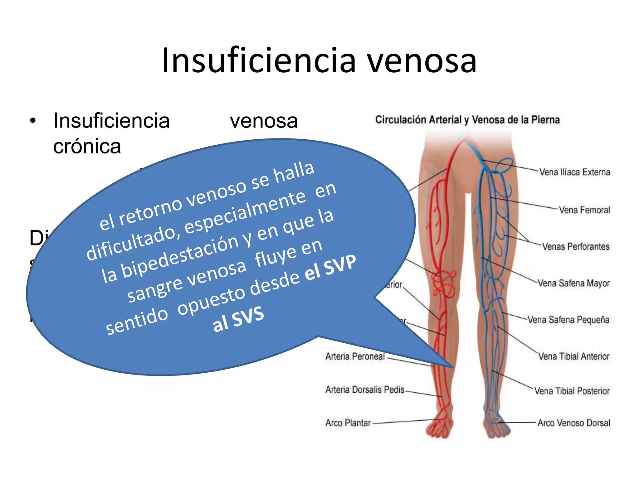 Insuficiencia venosa | PPT