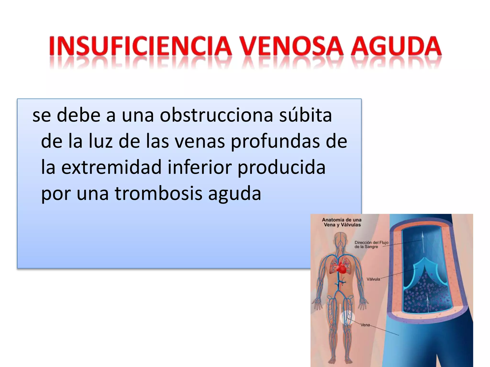 Insuficiencia venosa | PPTX