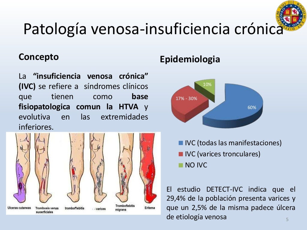 INSUFICIENCIA VENOSA CRÓNICA