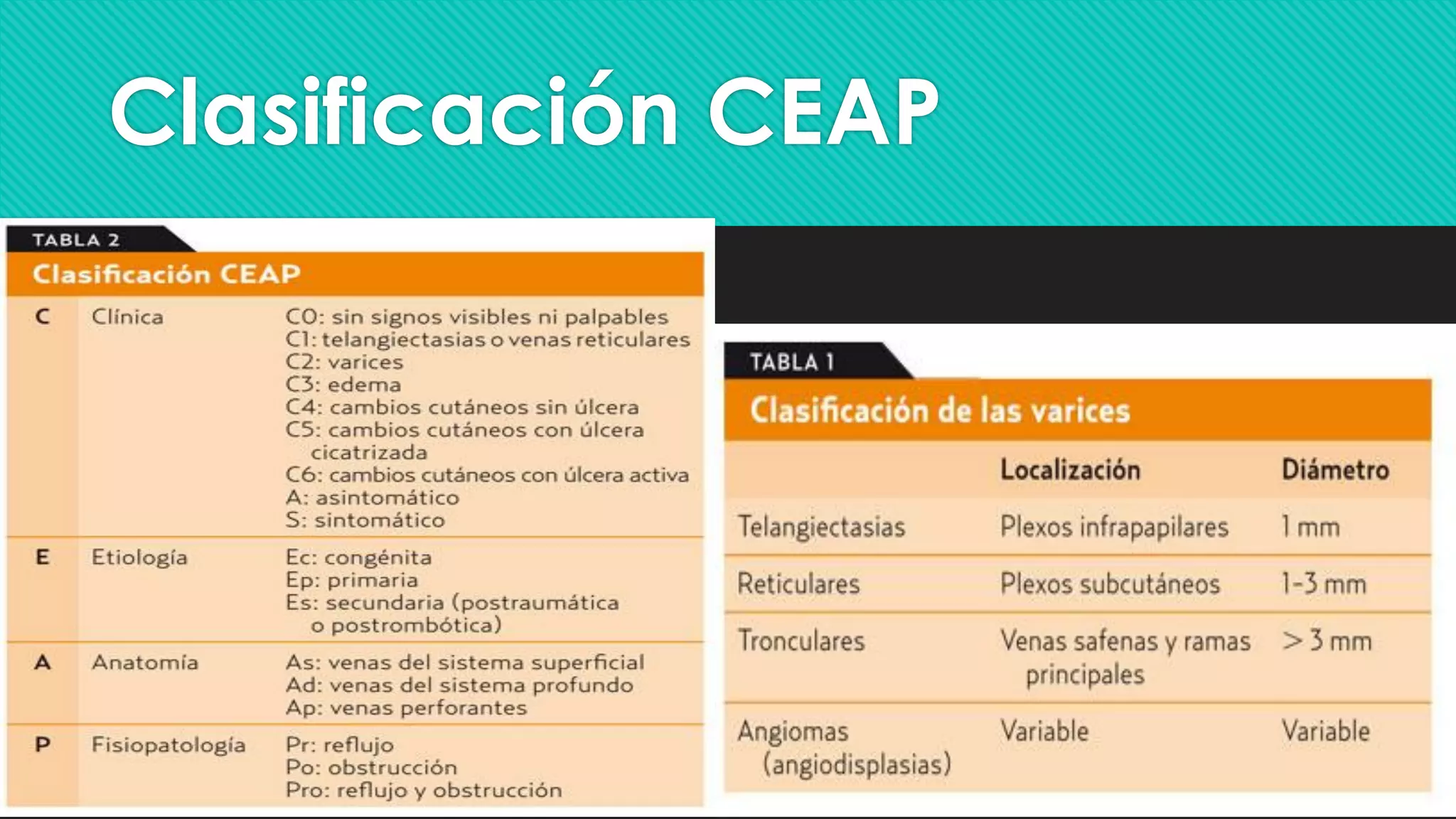 Insuficiencia venosa cronica