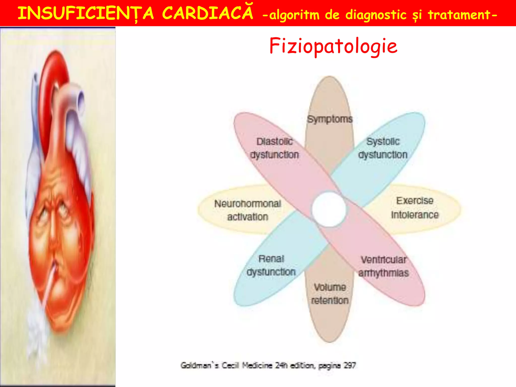Insuficienta cardiaca | PPTX