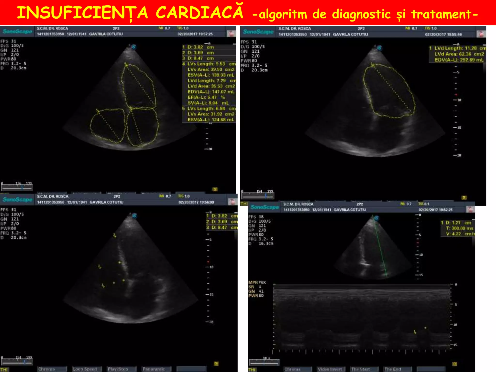 Insuficienta cardiaca | PPTX