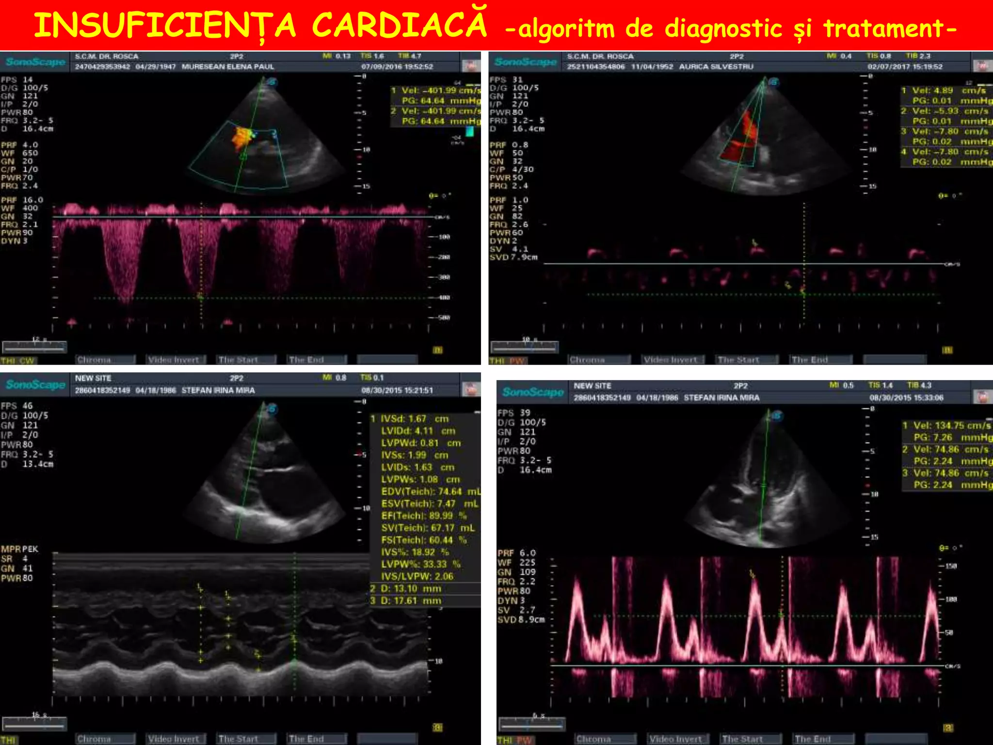 Insuficienta cardiaca | PPTX
