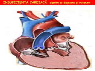 Insuficienta cardiaca | PPTX