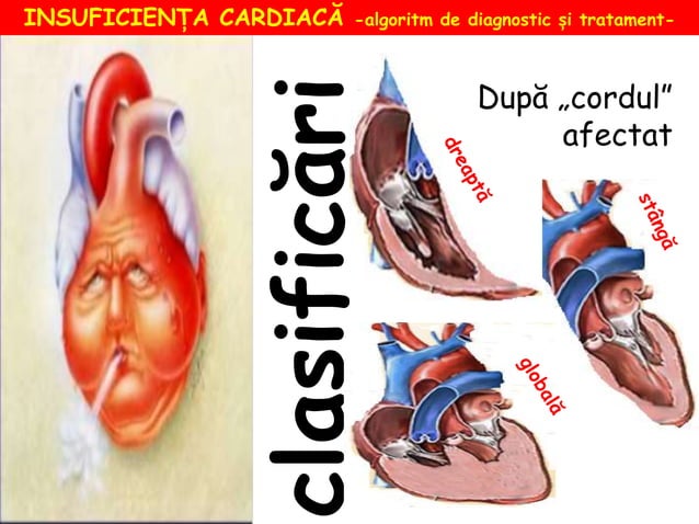 Insuficienta cardiaca | PPTX