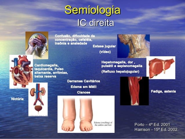 Insuficiência cardíaca congestiva