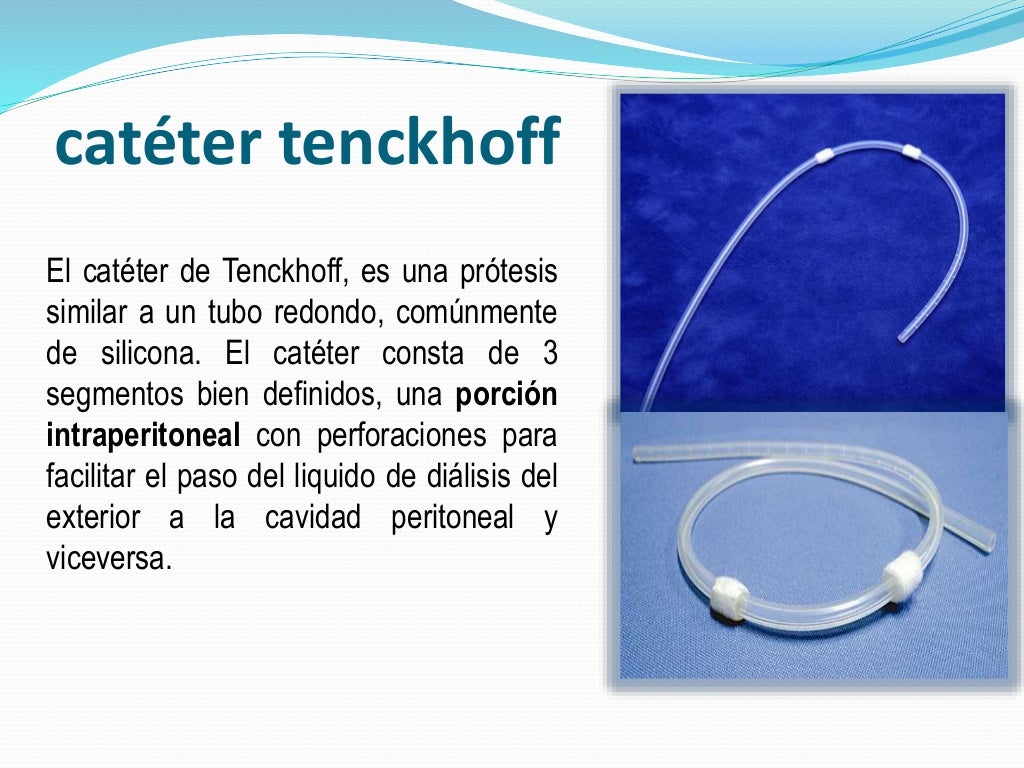 Insuficiencia renal crónica (IRC), Diálisis, cateter tenckhoff
