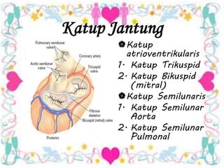 Insufisiensi katup trikuspidalis | PPT