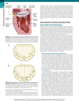 INSUFICIENCIA MITRAL BRAUNWALD CAPÍTULO 12.pdf