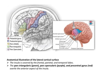 INSULAR GLIOMA SURGERY.pptx