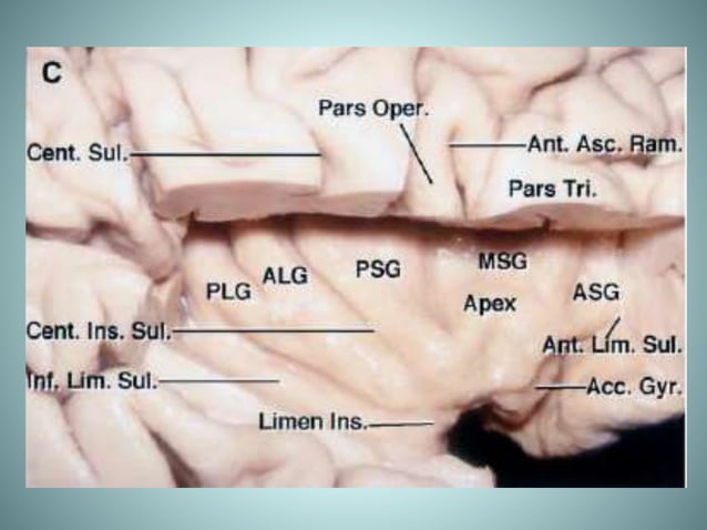 Insular lobe anatomy | PPTX | Brain and Nervous System Disorders ...