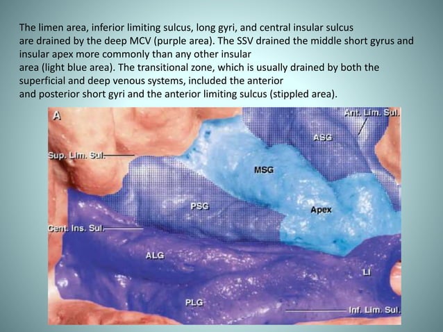 Insular lobe anatomy | PPTX | Brain and Nervous System Disorders ...