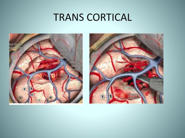 Insular lobe anatomy | PPTX | Brain and Nervous System Disorders ...
