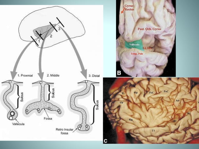Insular lobe anatomy | PPTX | Brain and Nervous System Disorders ...