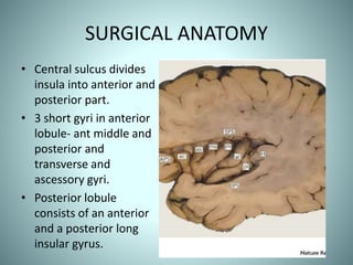Insular lobe anatomy | PPTX | Brain and Nervous System Disorders ...