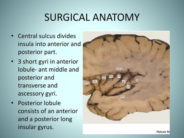 Insular lobe anatomy | PPTX | Brain and Nervous System Disorders ...