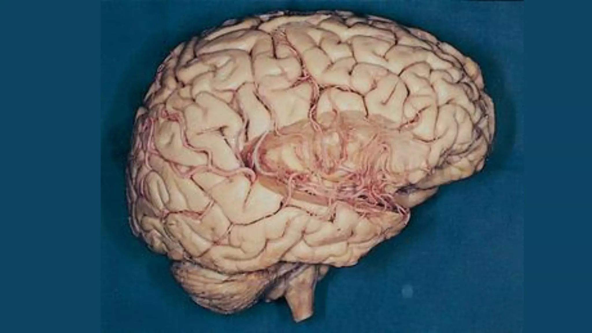insular lobe.pdf