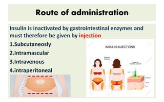 Insulin pediatric | PPTX