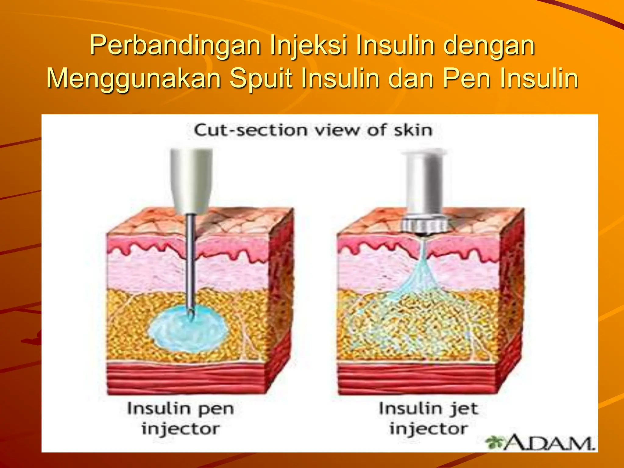 Pengertian Insulin BY Arifffffff Hendraakusma | PPT