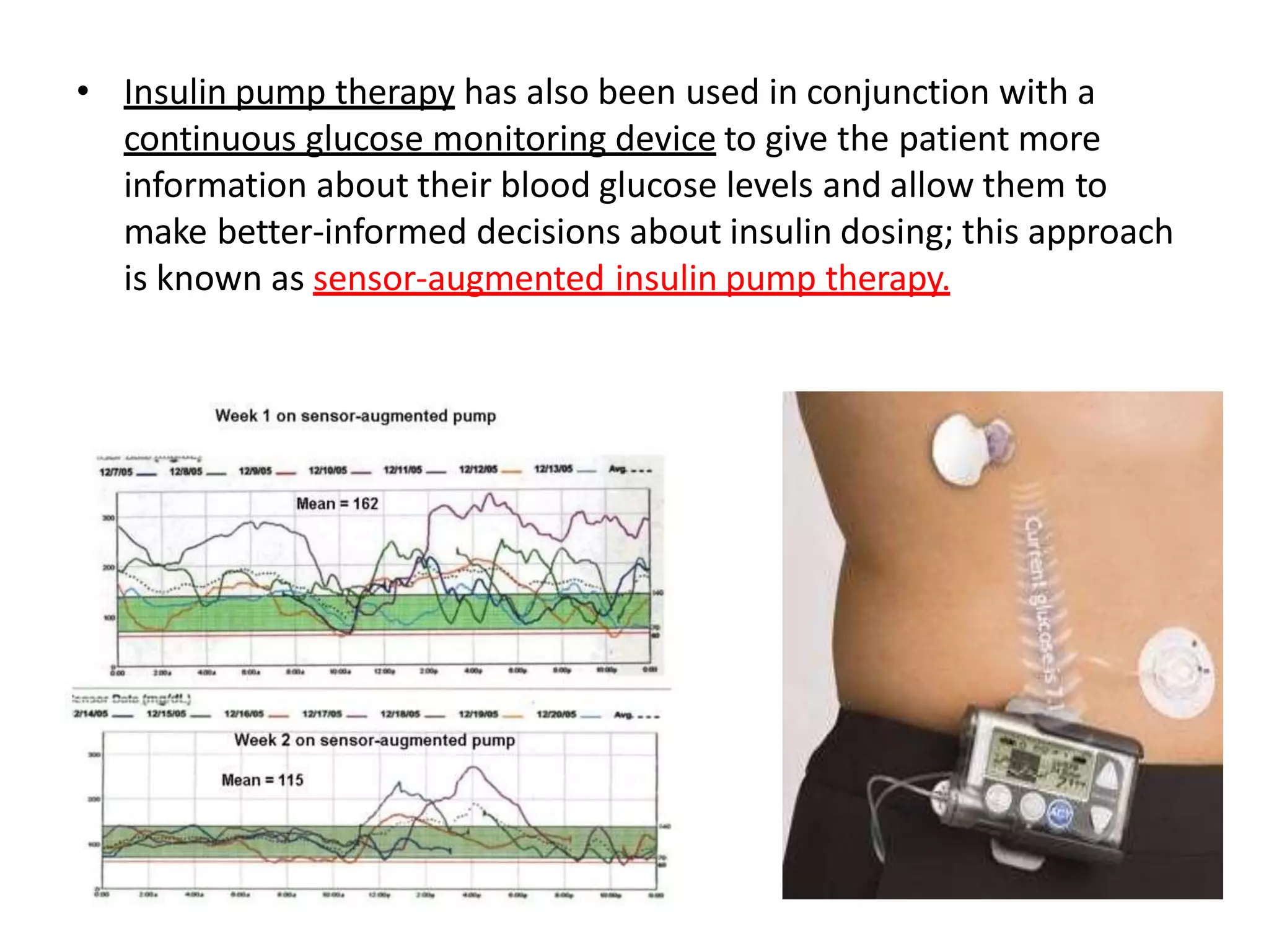 insulin-delivery-devices.pptx