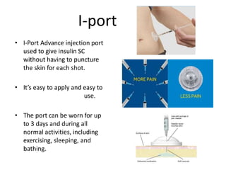 insulin-delivery-devices.pptx