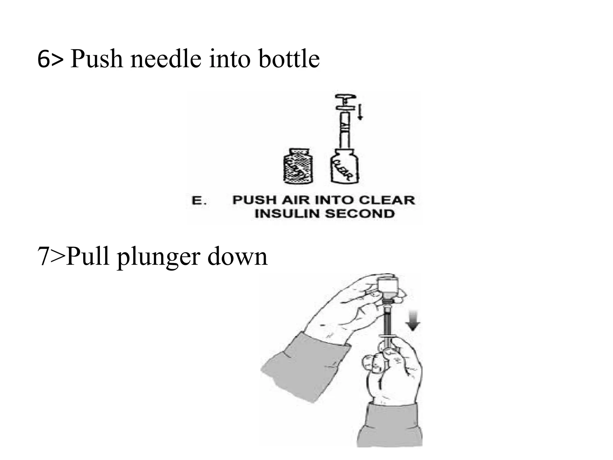 Insulin giving techniques | PPT