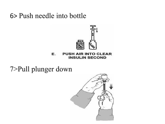 Insulin giving techniques | PPT