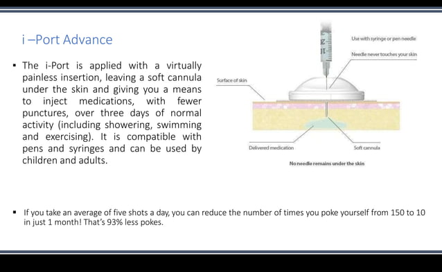 INSULIN DELIVERY METHODS.pptx