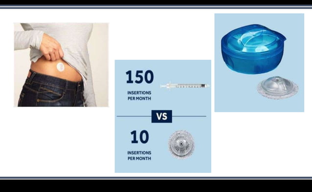 INSULIN DELIVERY METHODS.pptx