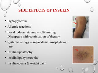 insulin therapy manage final - Copy.pptx