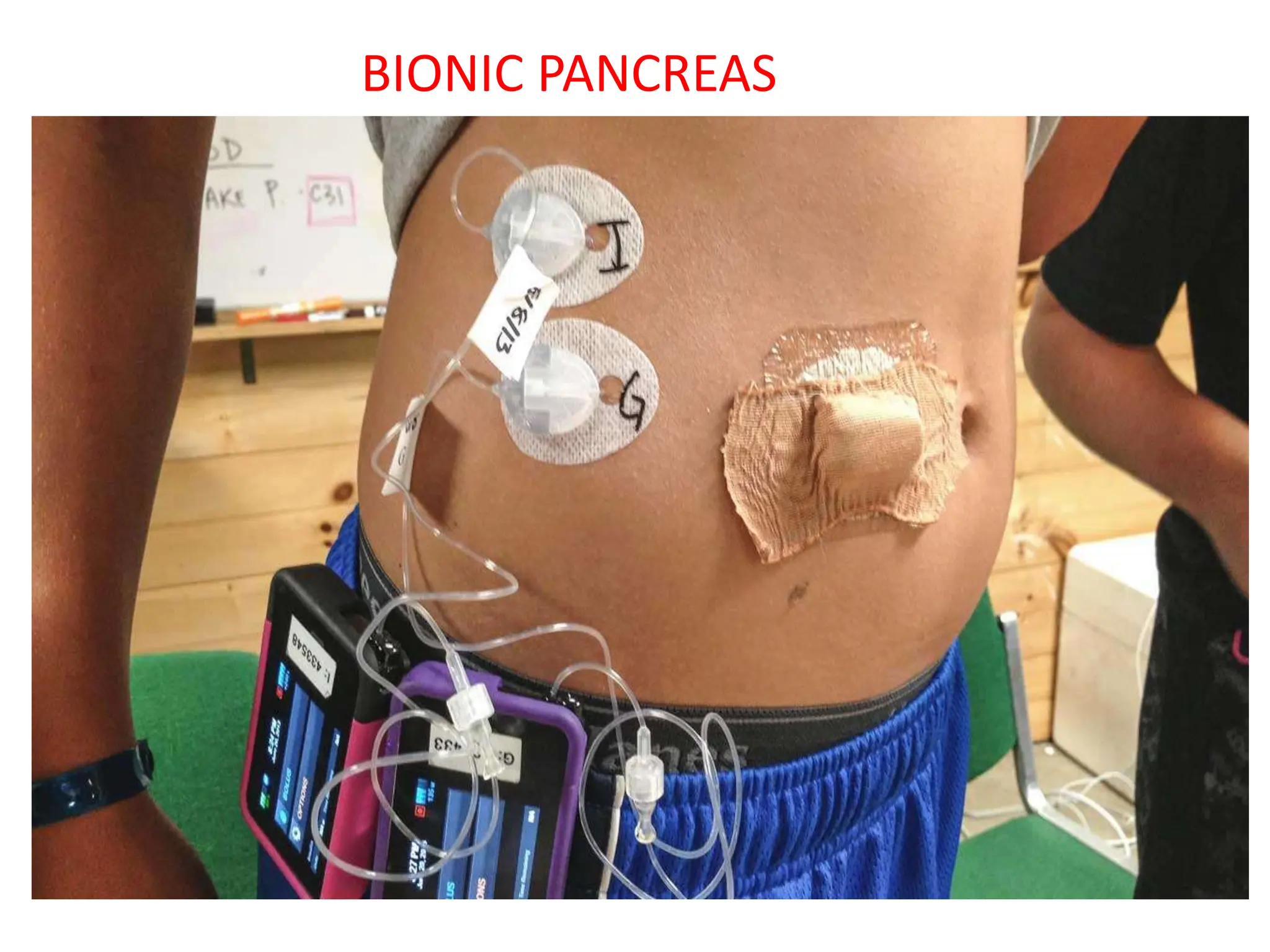 insulinppt-180904184611.pdf