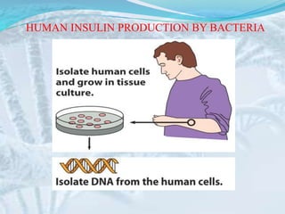 Insulin production | PPTX