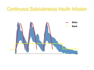 Insulin Pump | PPT