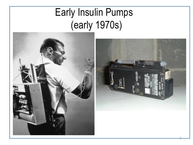 Insulin Pump
