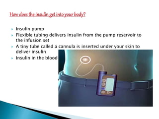insulin pump CSII | PPTX
