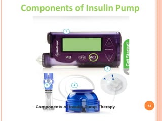 Insulin pump | PPT