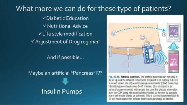 Insulin pump therapy