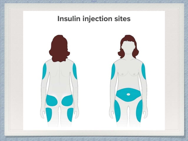 INSULIN TECHNIQUE AND STORAGE ppt.pptx
