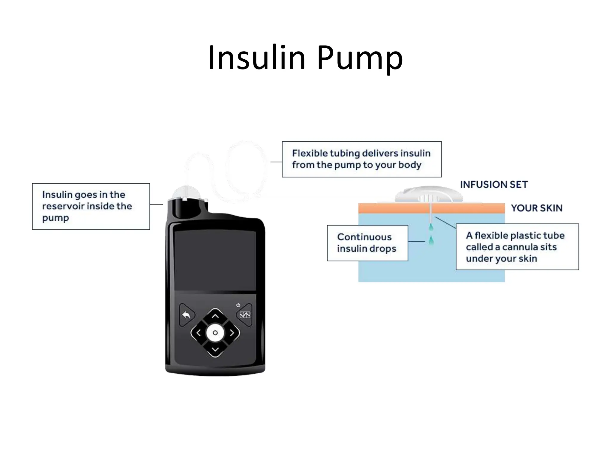 INSULI THERAPY.pptx. All about Insulin, Mode of ation, doses. | PPTX