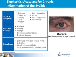 InSite Vision Corporate Presentation | PPT