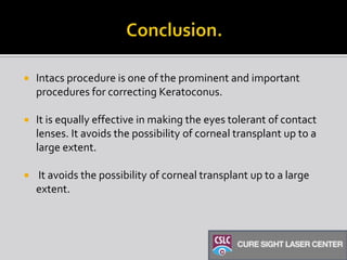 Intacs and corneal collagen cross linking, two new but effective ...