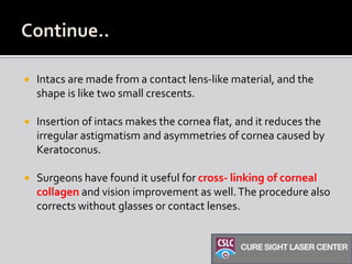 Intacs and corneal collagen cross linking, two new but effective ...