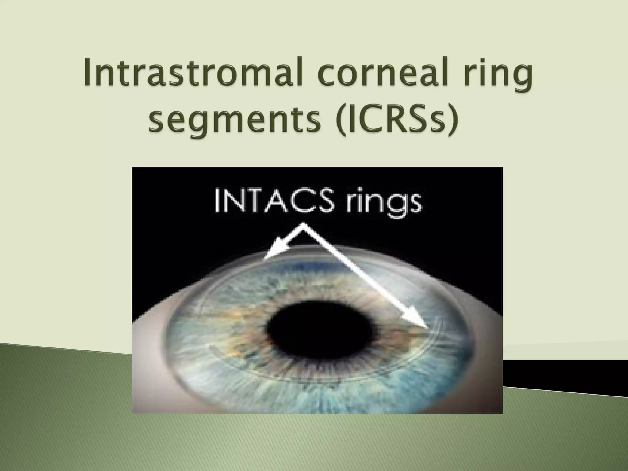 Intrastromal Corneal Ring Segment (ICRSs) | PDF
