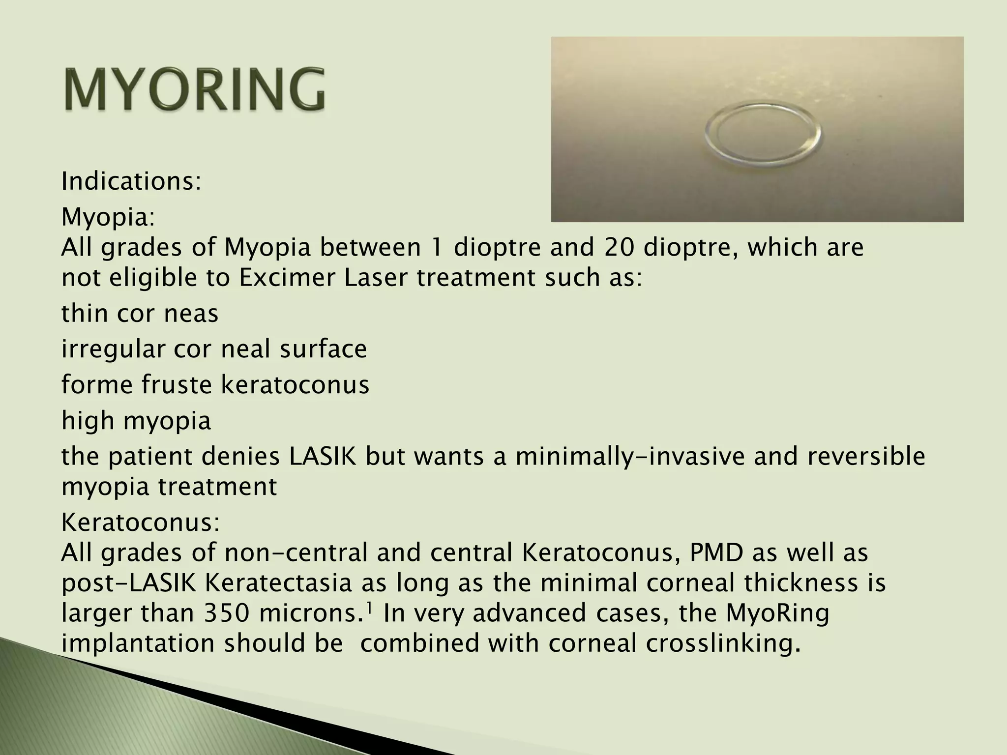 Intrastromal Corneal Ring Segment (ICRSs) | PDF