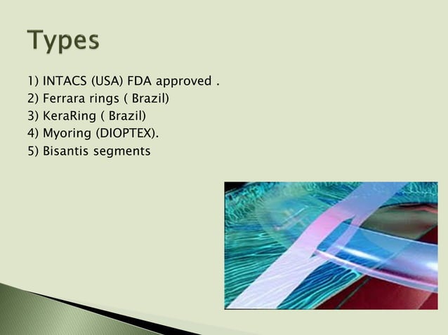 Intrastromal Corneal Ring Segment (ICRSs) | PPT