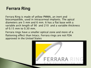 Intrastromal Corneal Ring Segment (ICRSs) | PPT
