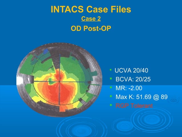 Intacs, Corneal inserts for treatment of keratoconus and ectasia | PPT ...