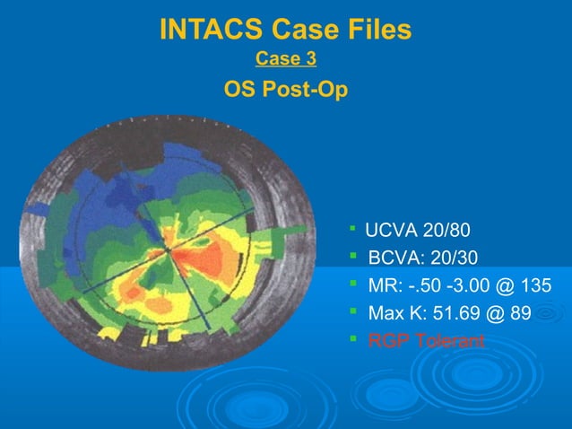 Intacs, Corneal inserts for treatment of keratoconus and ectasia | PPT ...