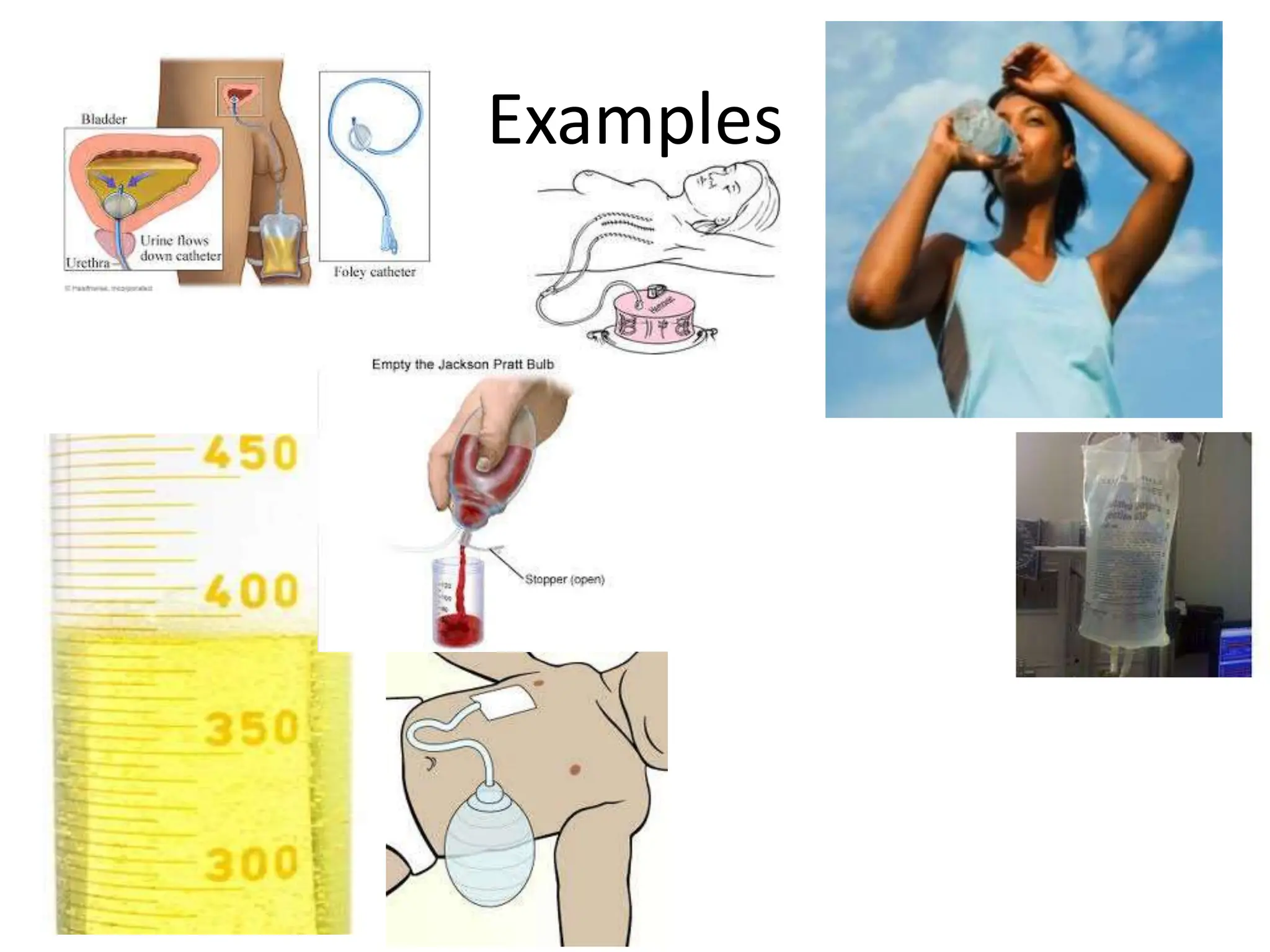 Intake & Output Calculations in Nursing. | PPTX