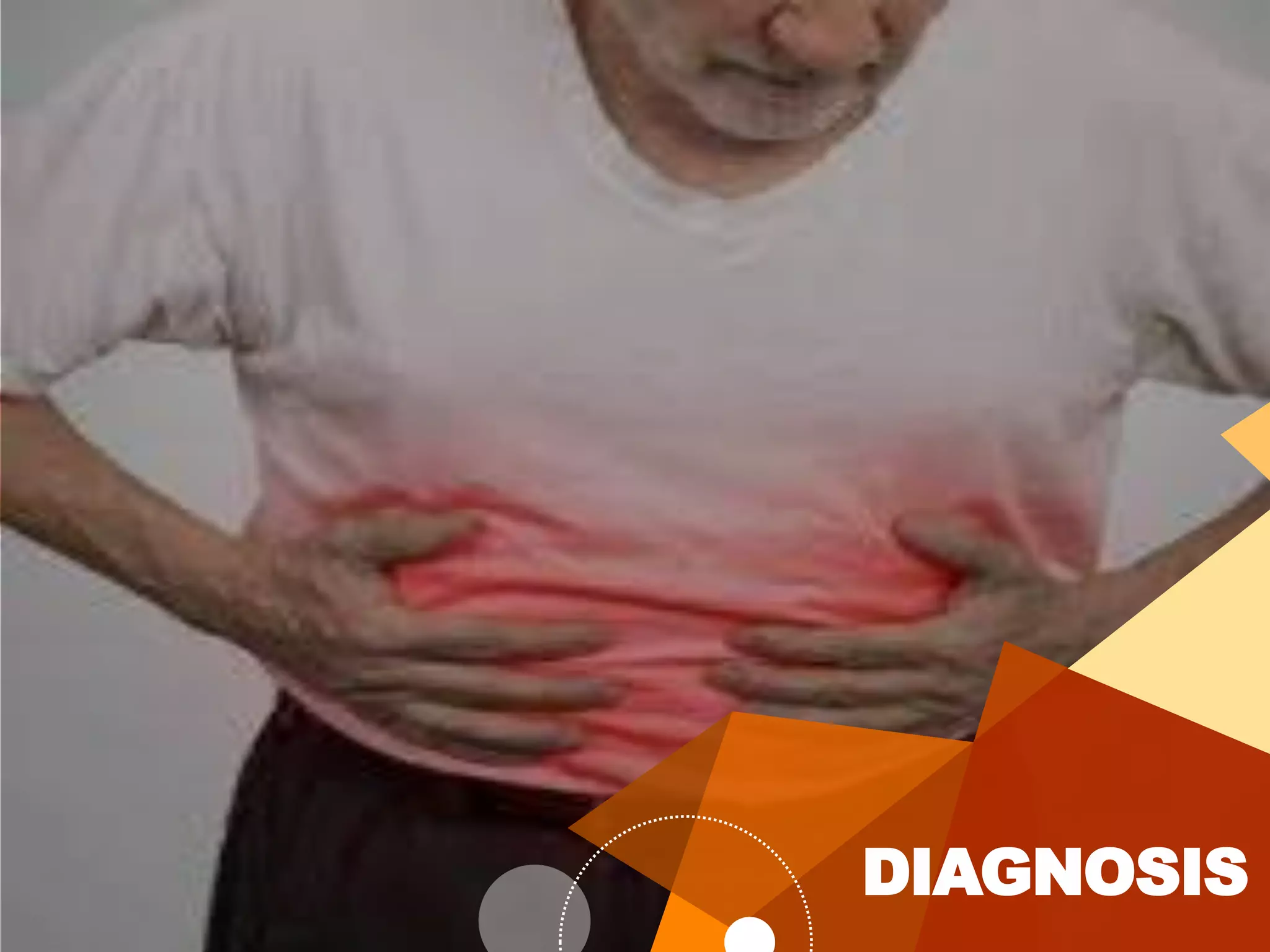 Intra-abdominal infections | PPTX